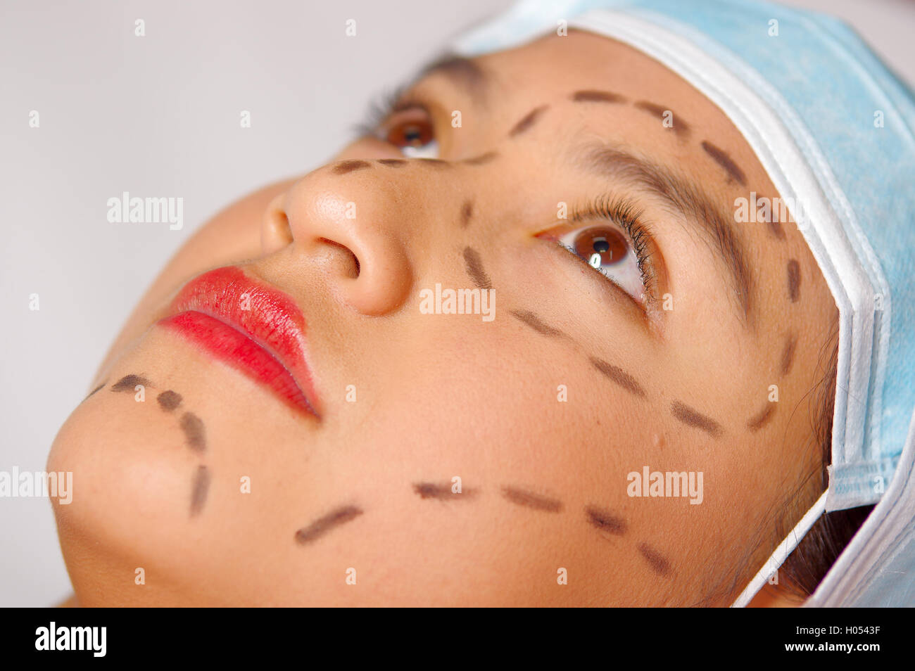 Closeup young womans face preparing for cosmetic surgery with lines ...