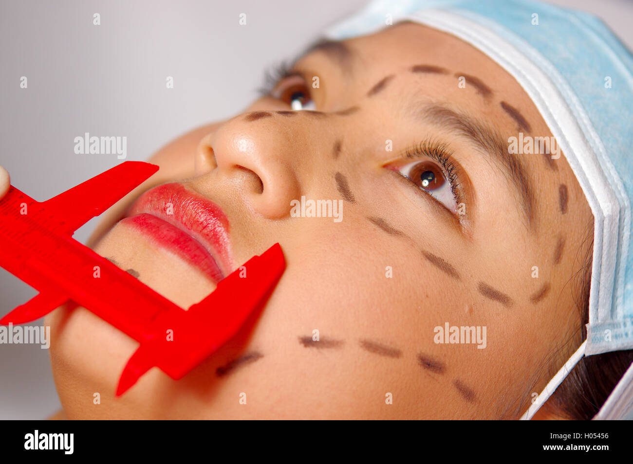 Closeup young womans face preparing for cosmetic surgery with lines ...