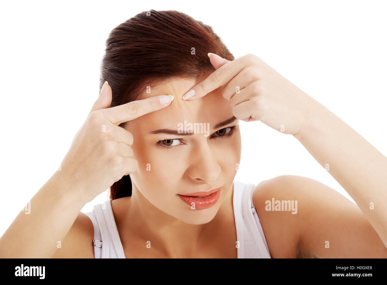 White spots on forehead hi-res stock photography and images - Alamy