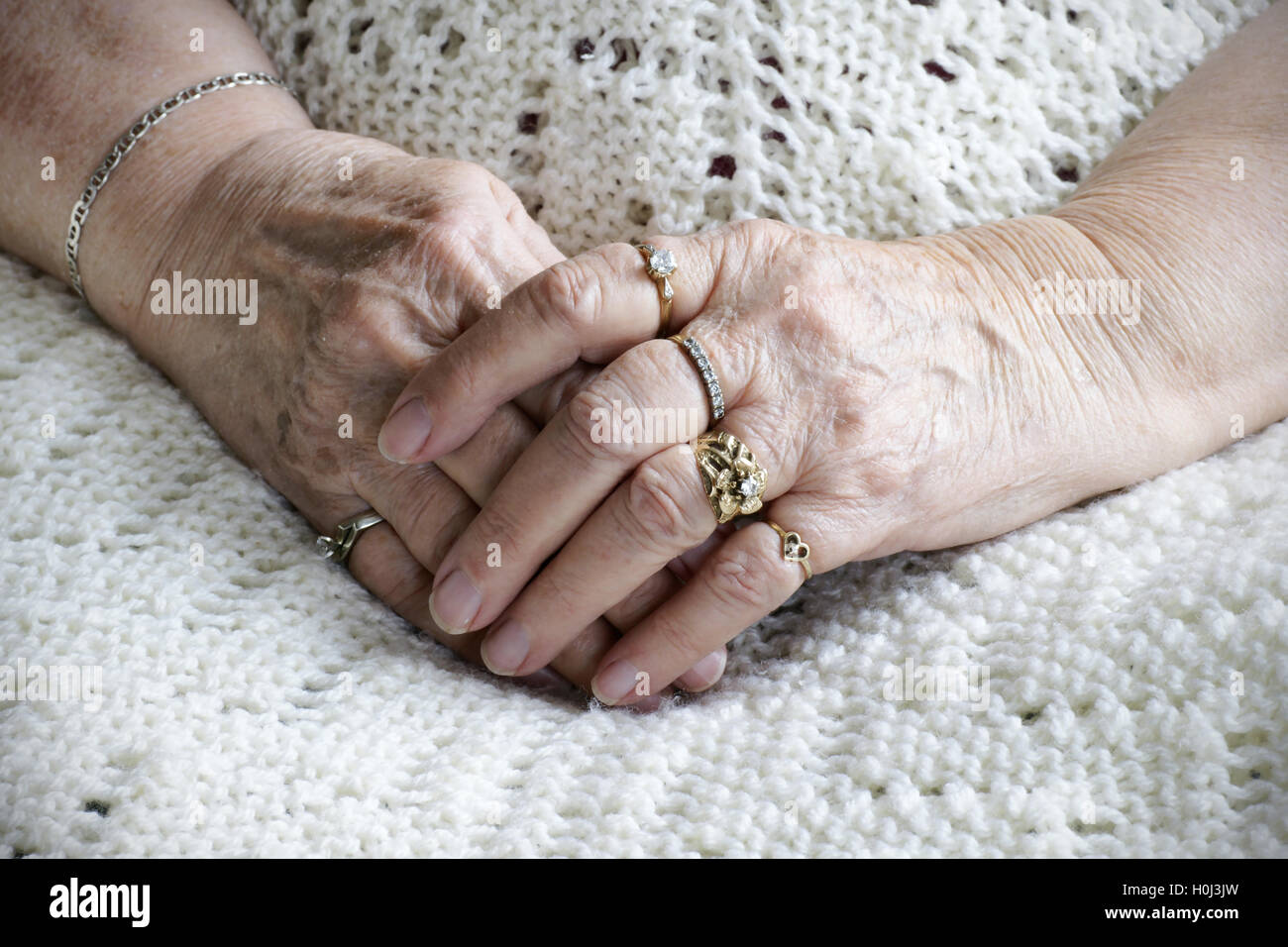 Age spot woman hi-res stock photography and images - Alamy