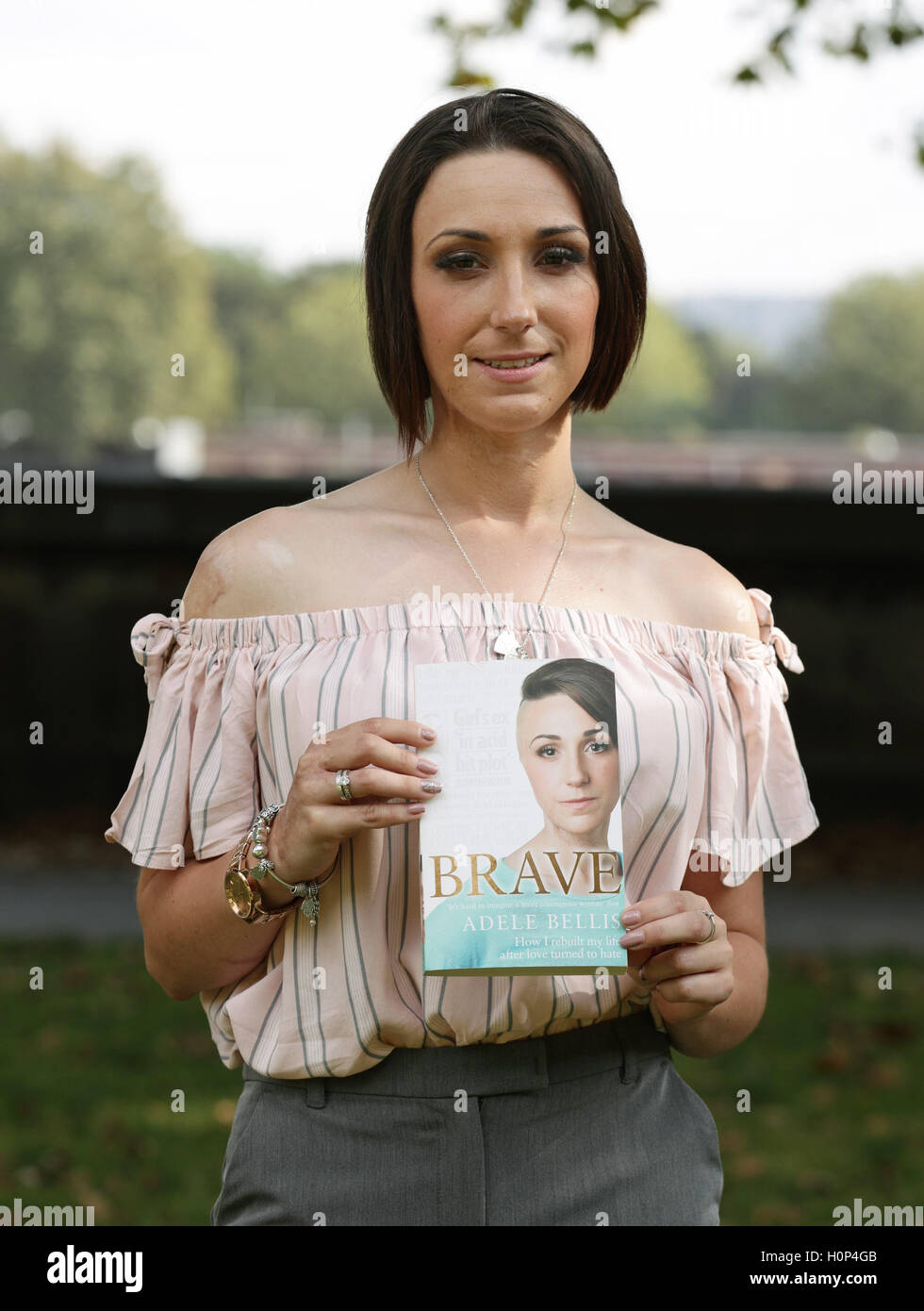 Scarred for life hi-res stock photography and images - Alamy