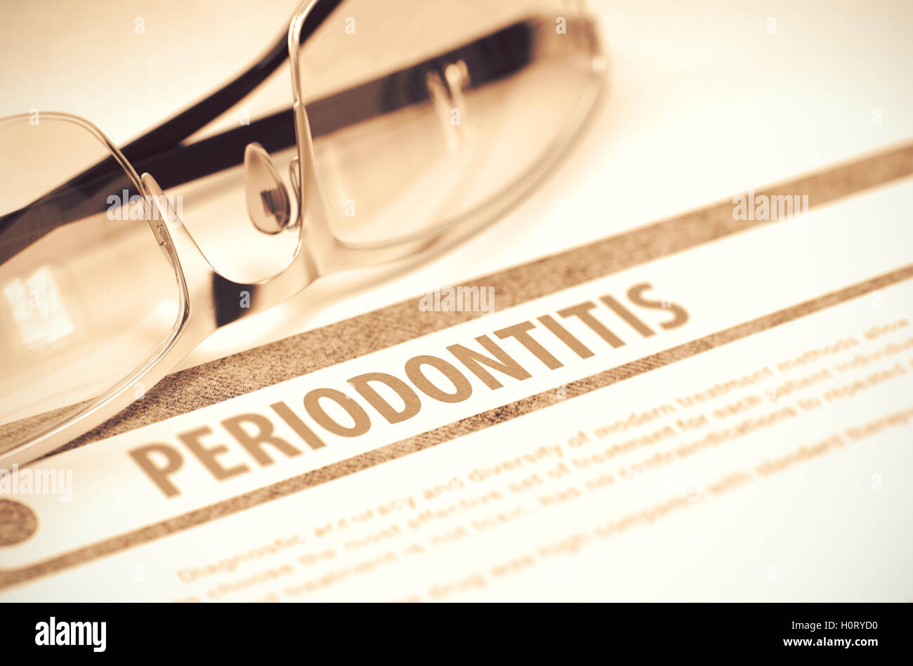 Periodontitis illustration hi-res stock photography and images - Alamy