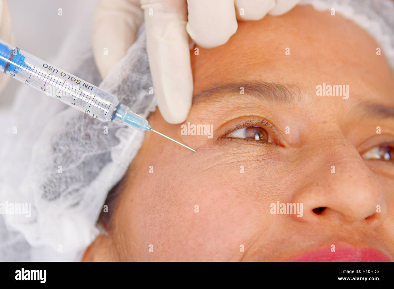 Closeup womans face receiving anti wrinkle injections with syringe ...