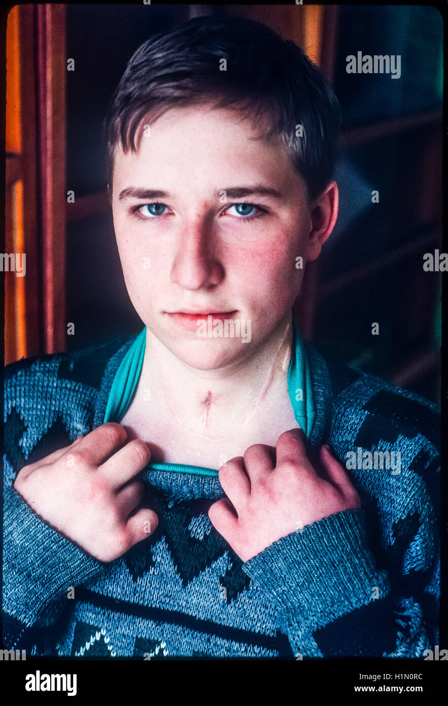 Medical center of Kiev child with thyroid cancer after the Chernobyl ...