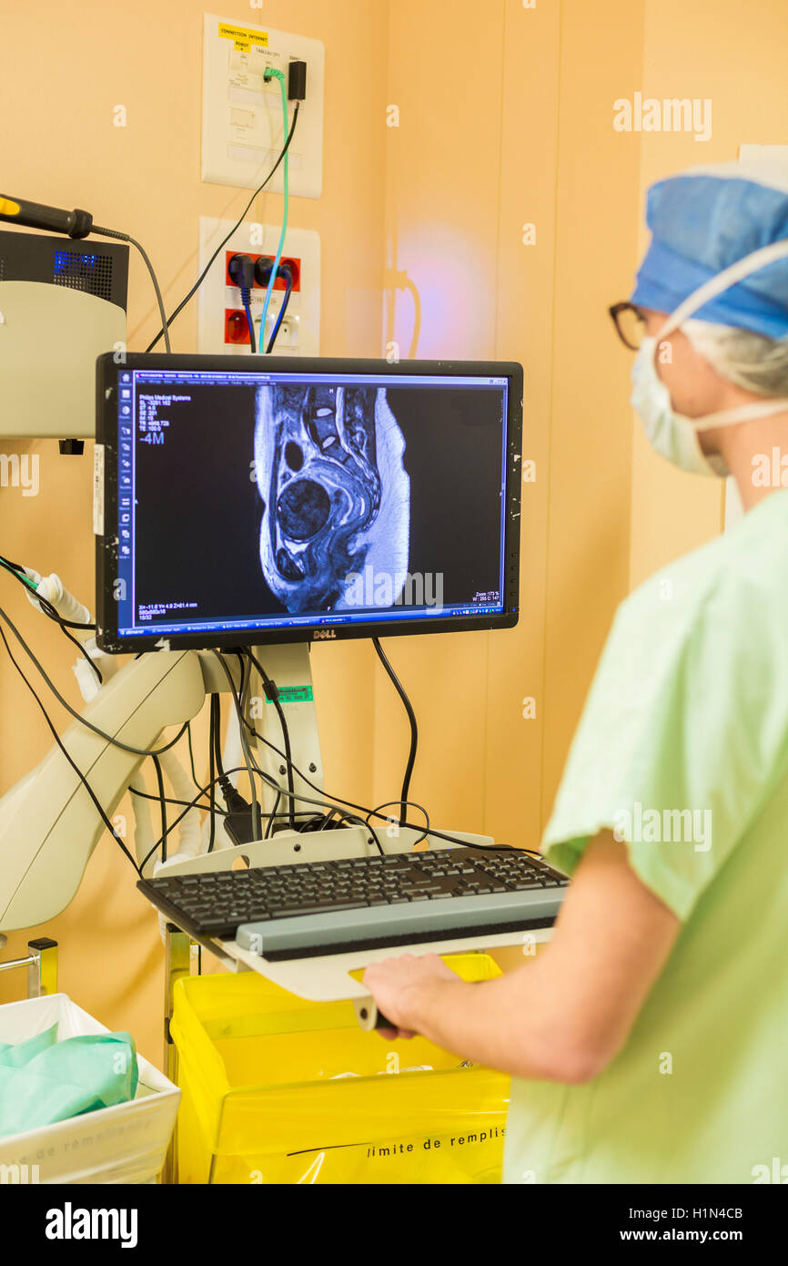 Fibroid womb hi-res stock photography and images - Alamy