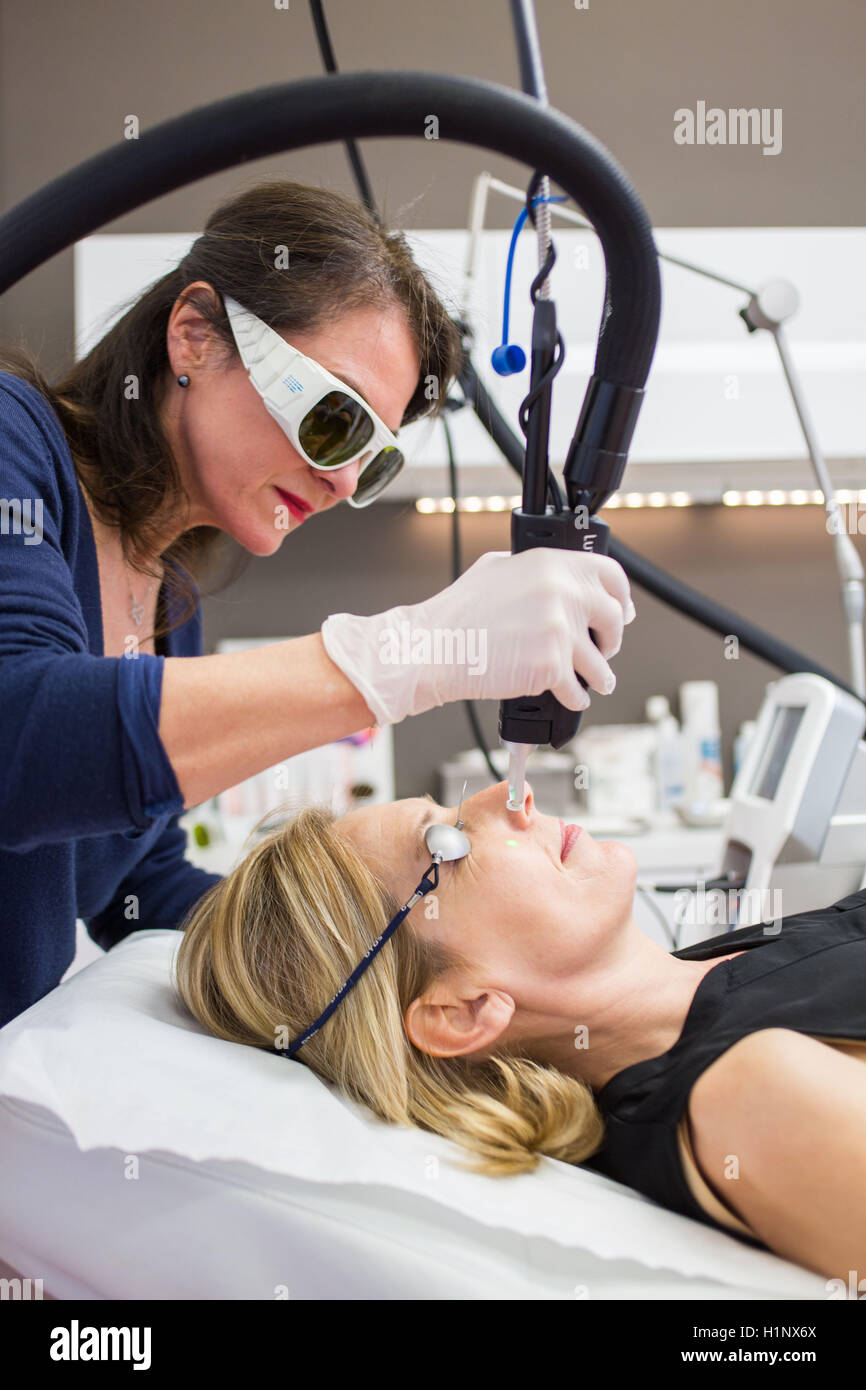 Vascular laser used in treatment of rosacea and varicosity Stock Photo ...