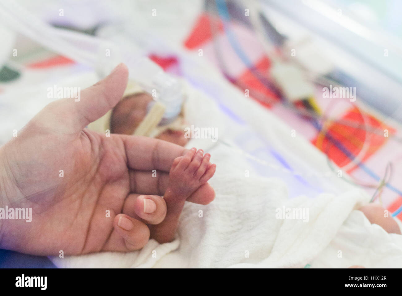 Premature Baby Hand High Resolution Stock Photography and Images - Alamy