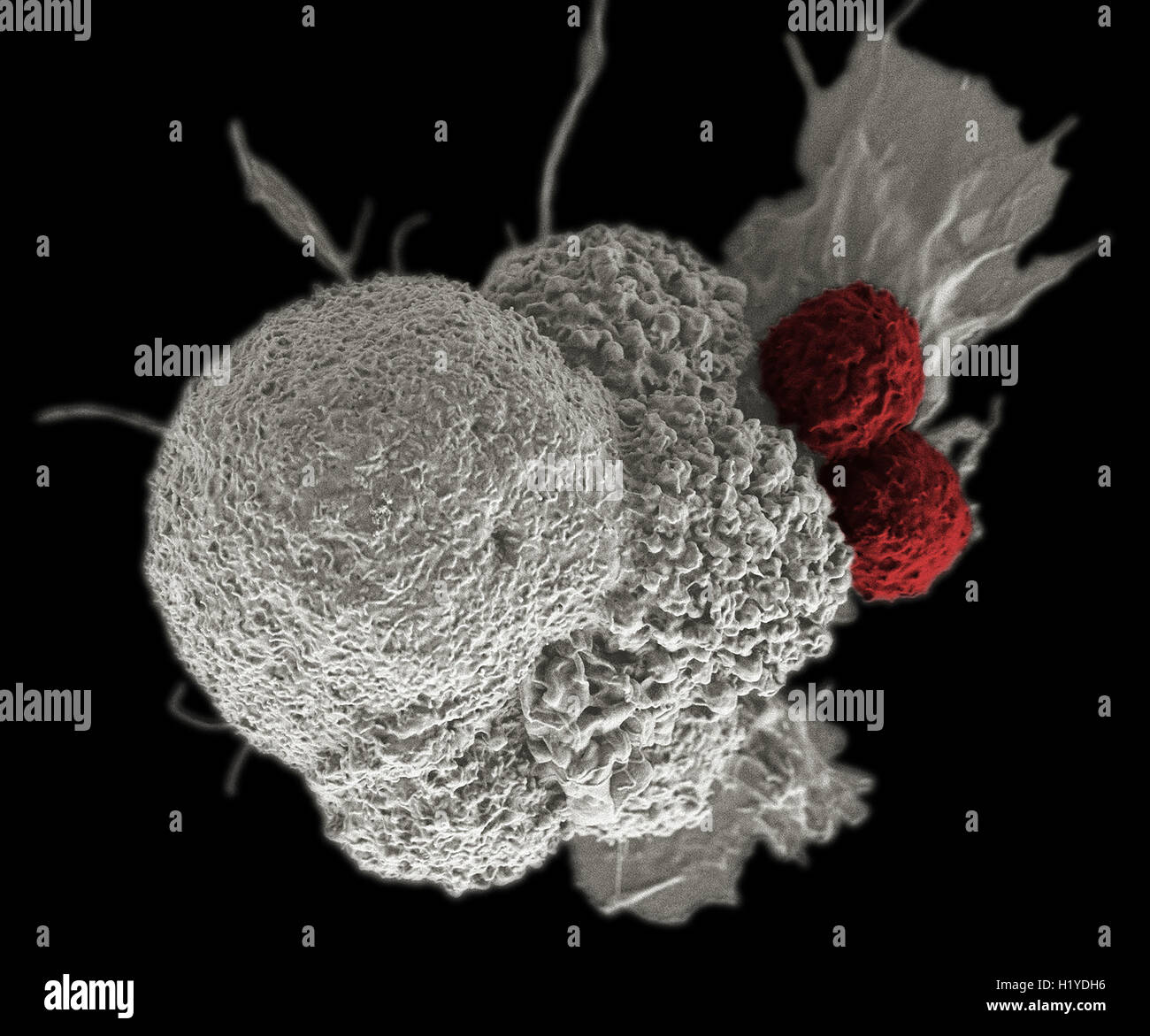 Cancer cell and t lymphocytes, sem hi-res stock photography and images ...