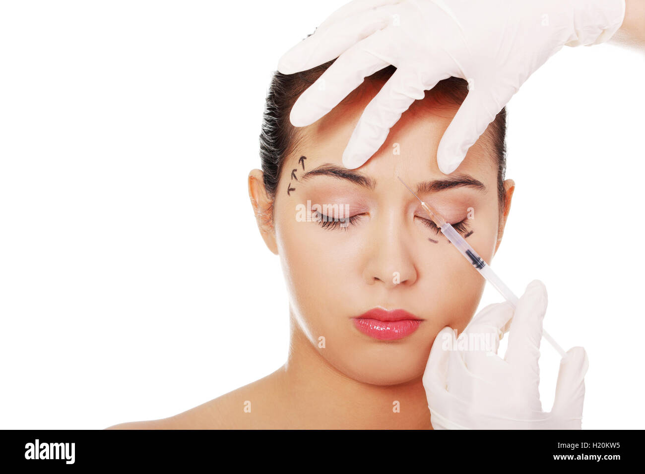 Cosmetic botox injection in the female face Stock Photo - Alamy