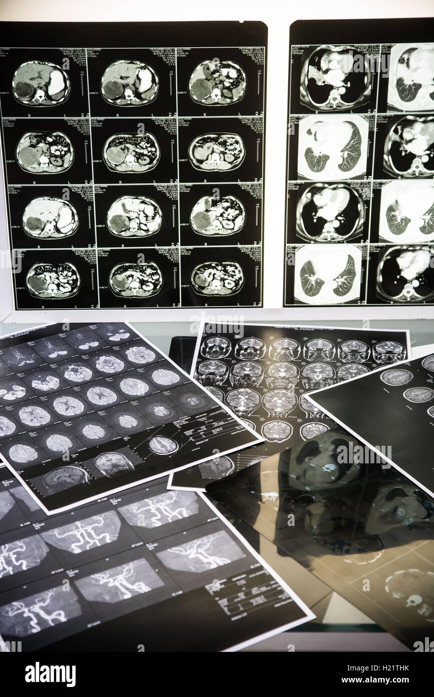 CT scan and MRI results Stock Photo - Alamy