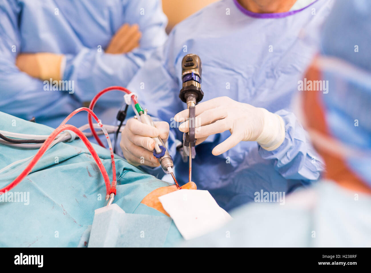 Sinus surgery, Surgeons performing functional endoscopic sinus surgery ...
