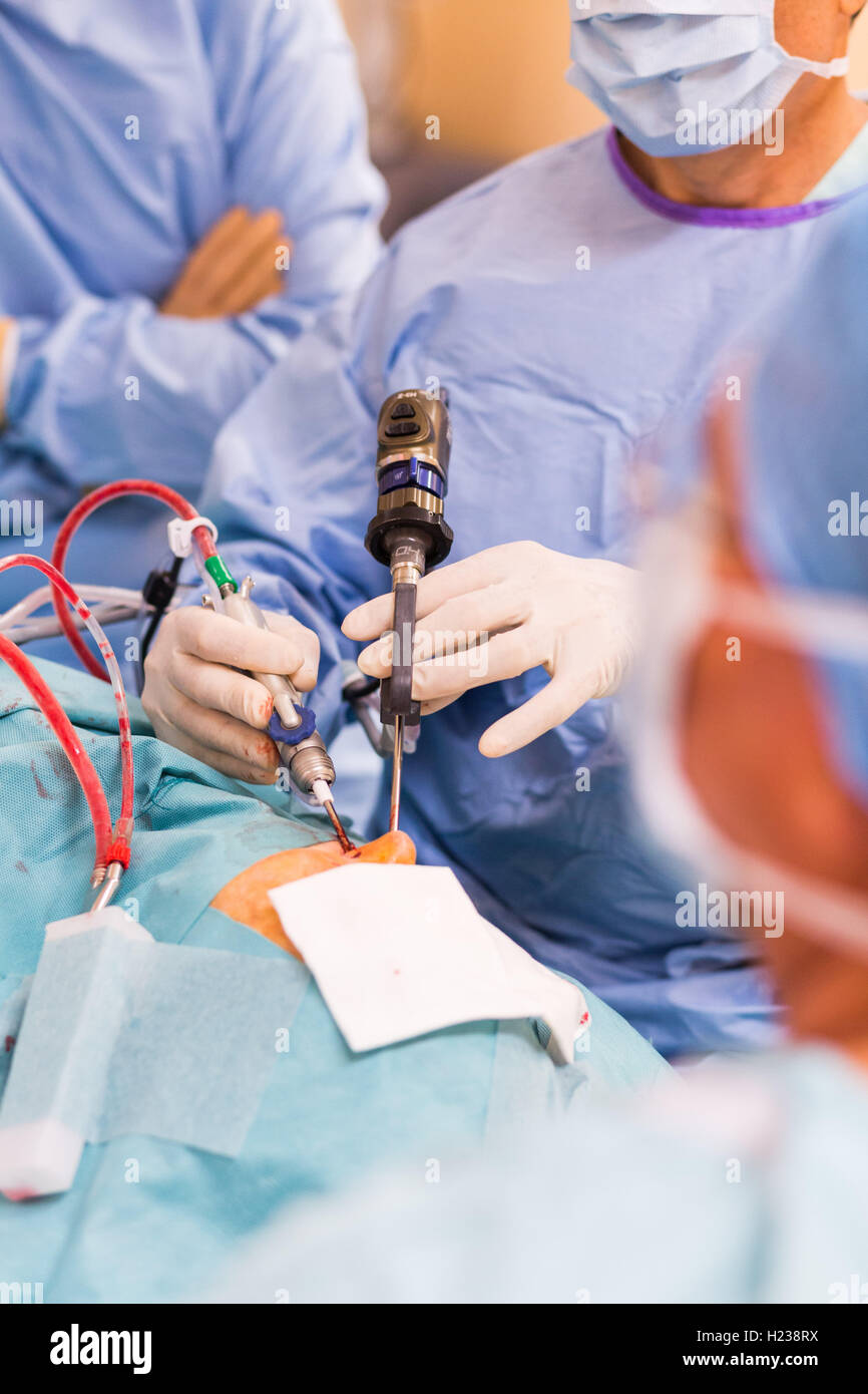 Endoscopic sinus surgery hi-res stock photography and images - Alamy