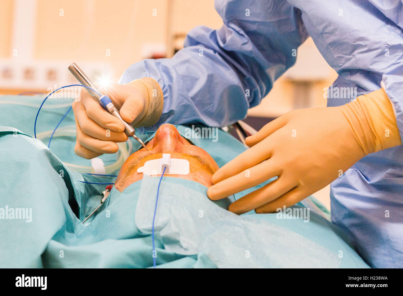 Sinus computer assisted surgery (neuronavigation). Surgeon performing ...