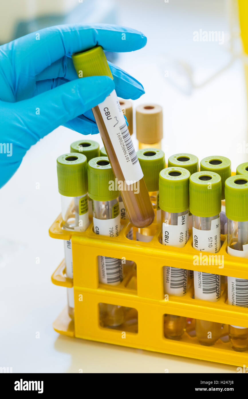 Urine analysis in laboratory Stock Photo - Alamy