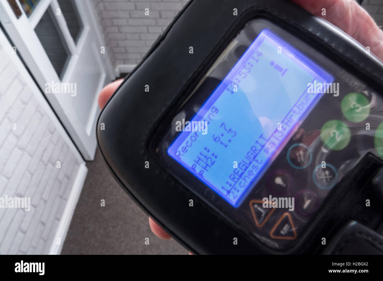 An electronic gastroesophageal acid reflux and indigestion recording ...