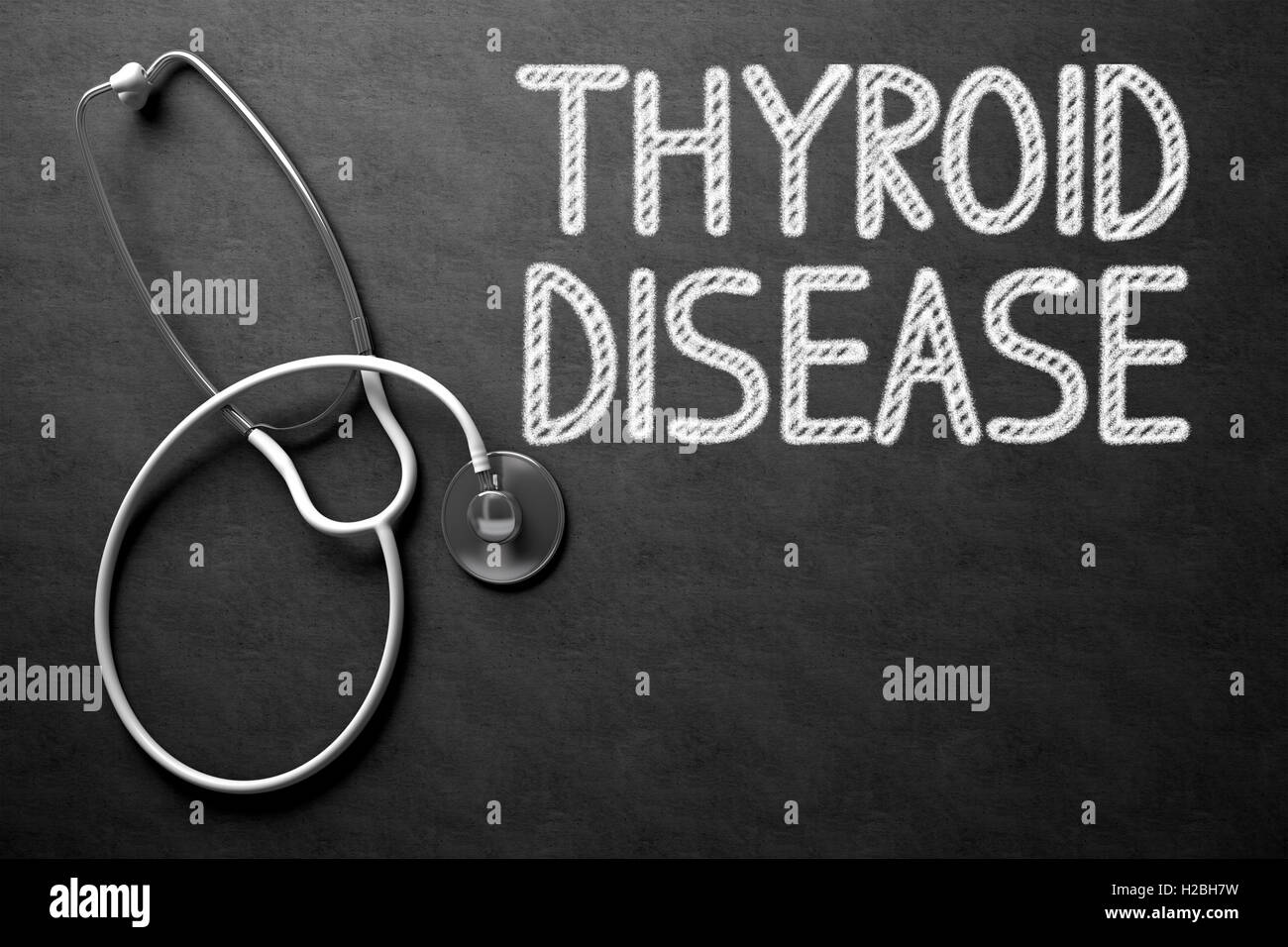 Thyroid Disease - Text on Chalkboard. 3D Illustration Stock Photo - Alamy