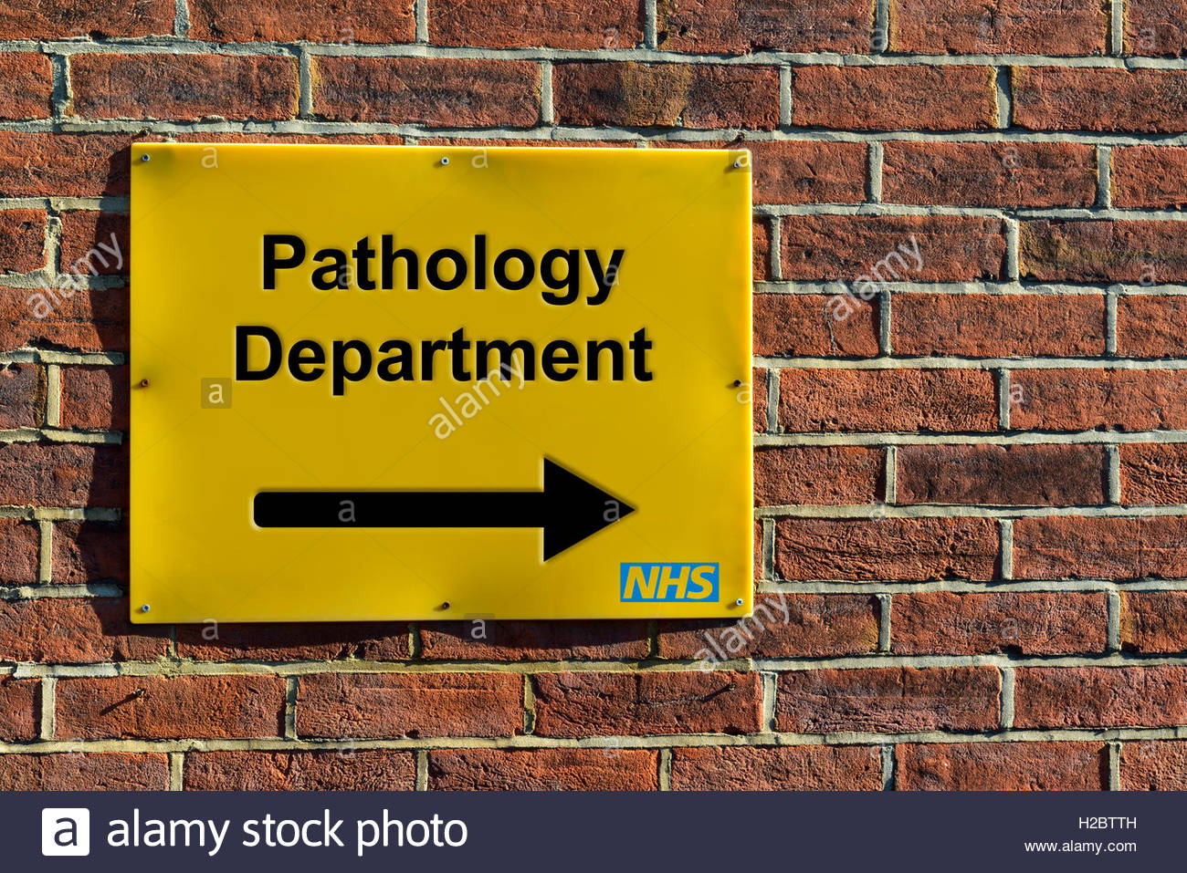 Clinical Pathology High Resolution Stock Photography and Images - Alamy
