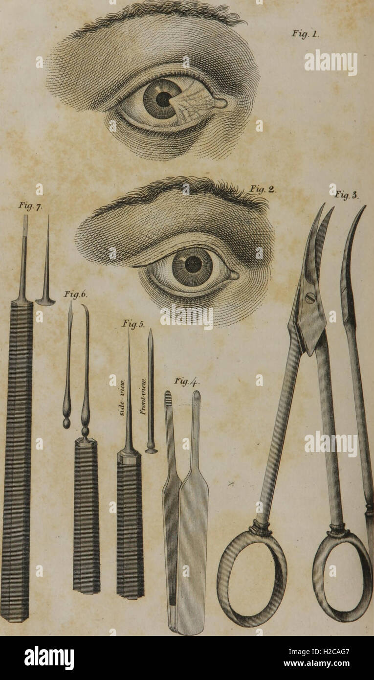 Elements of surgery- for the use of students - with plates (Volume 1 ...