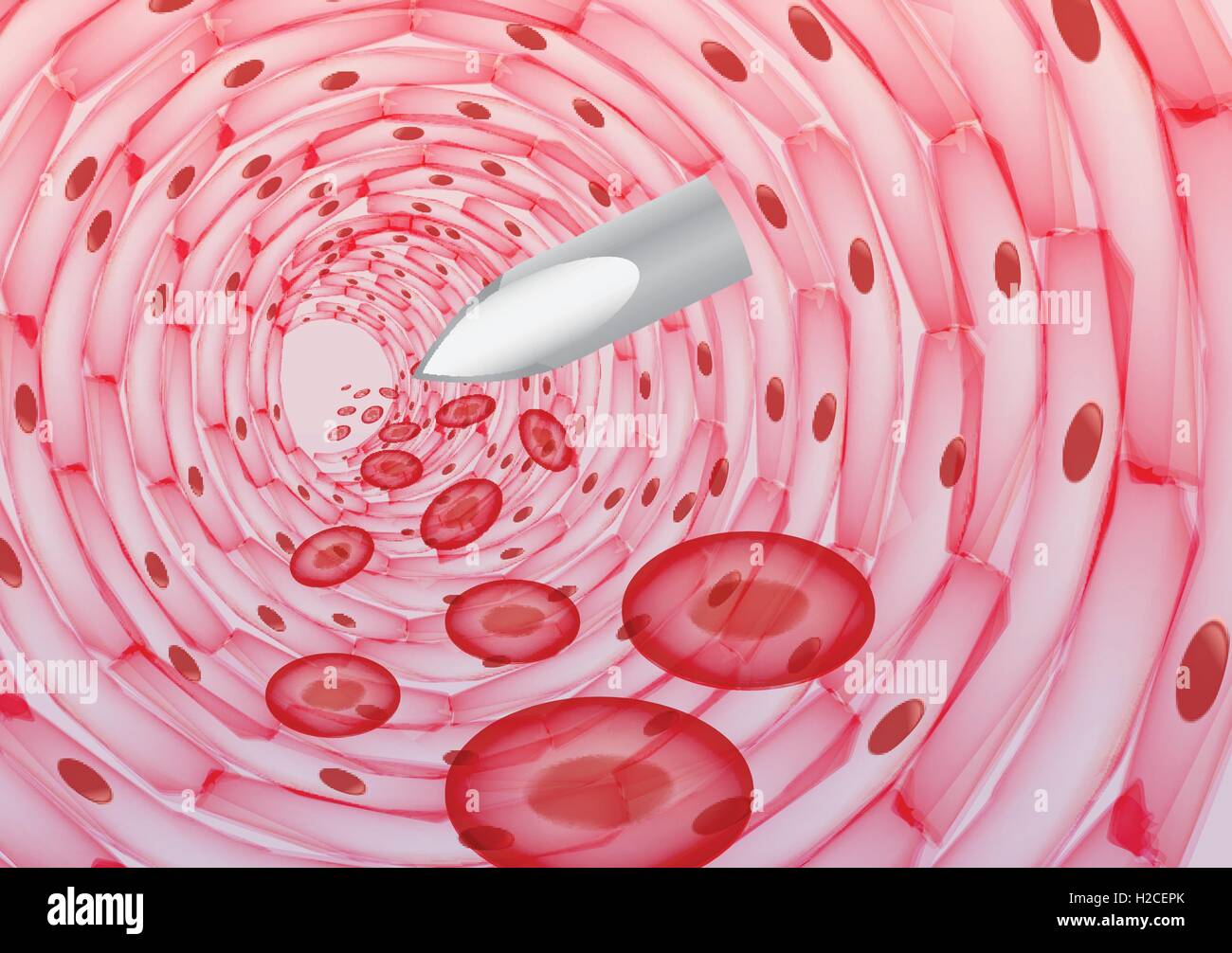 Injection in the Bloodstream with a Syringe from the Insid Stock Vector ...