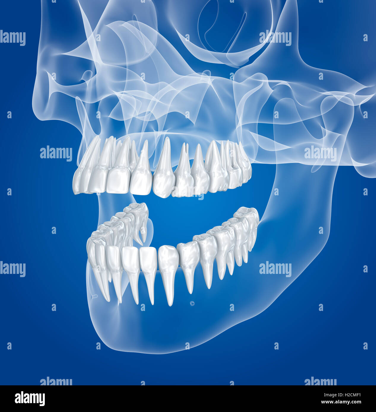 Transparent scull and teeth , xray view . 3D illustration Stock Photo ...