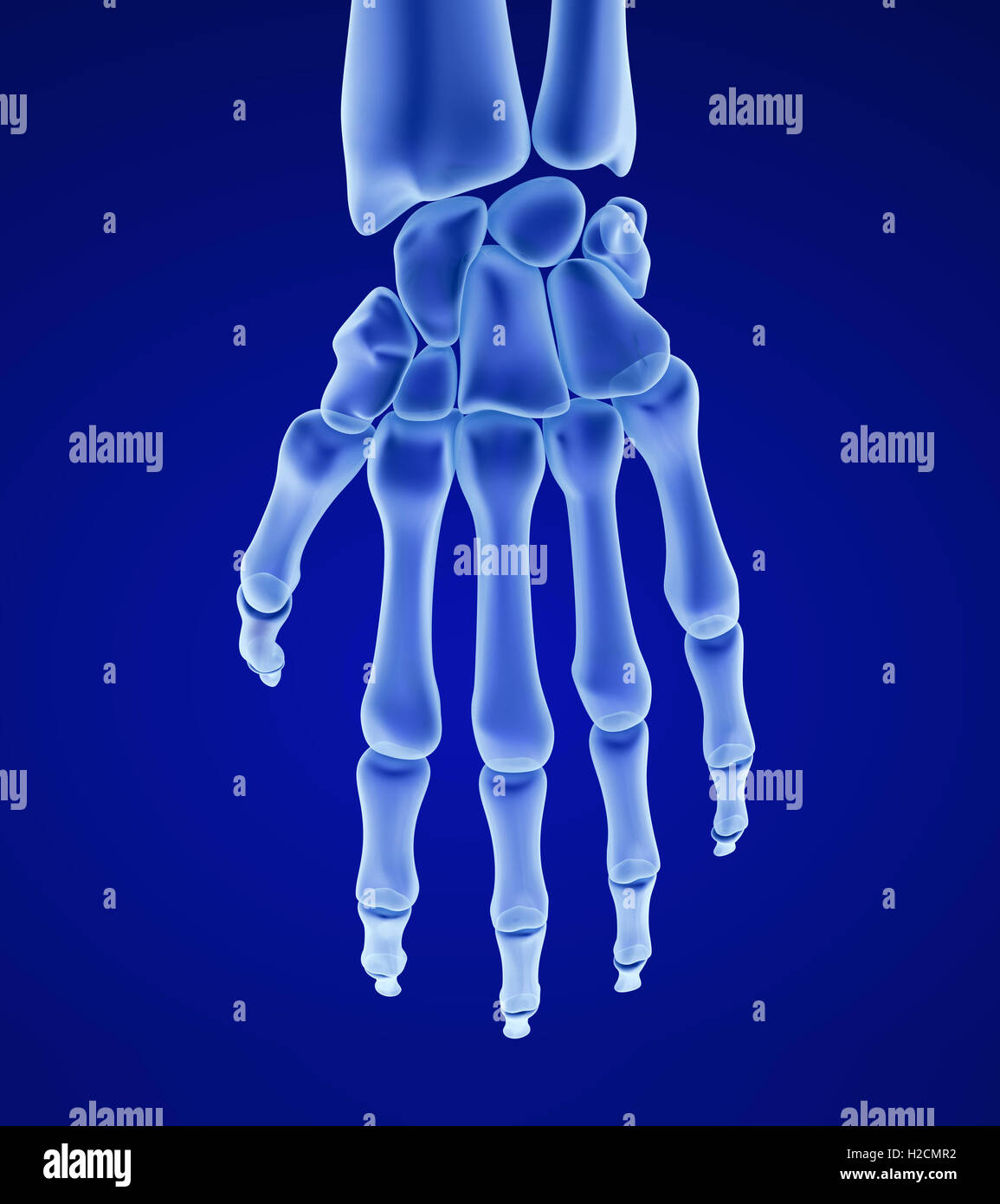 Human wrist anatomy. Xray view. Medically accurate 3D illustration ...