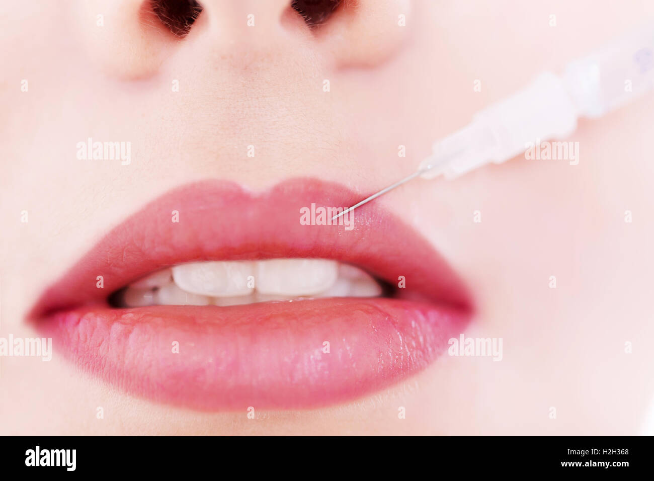 Injection of beauty hi-res stock photography and images - Alamy