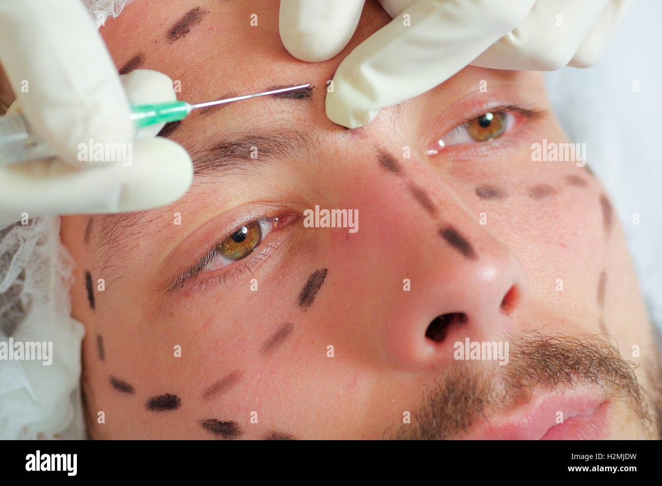 Face drawn botox syringe hi-res stock photography and images - Alamy