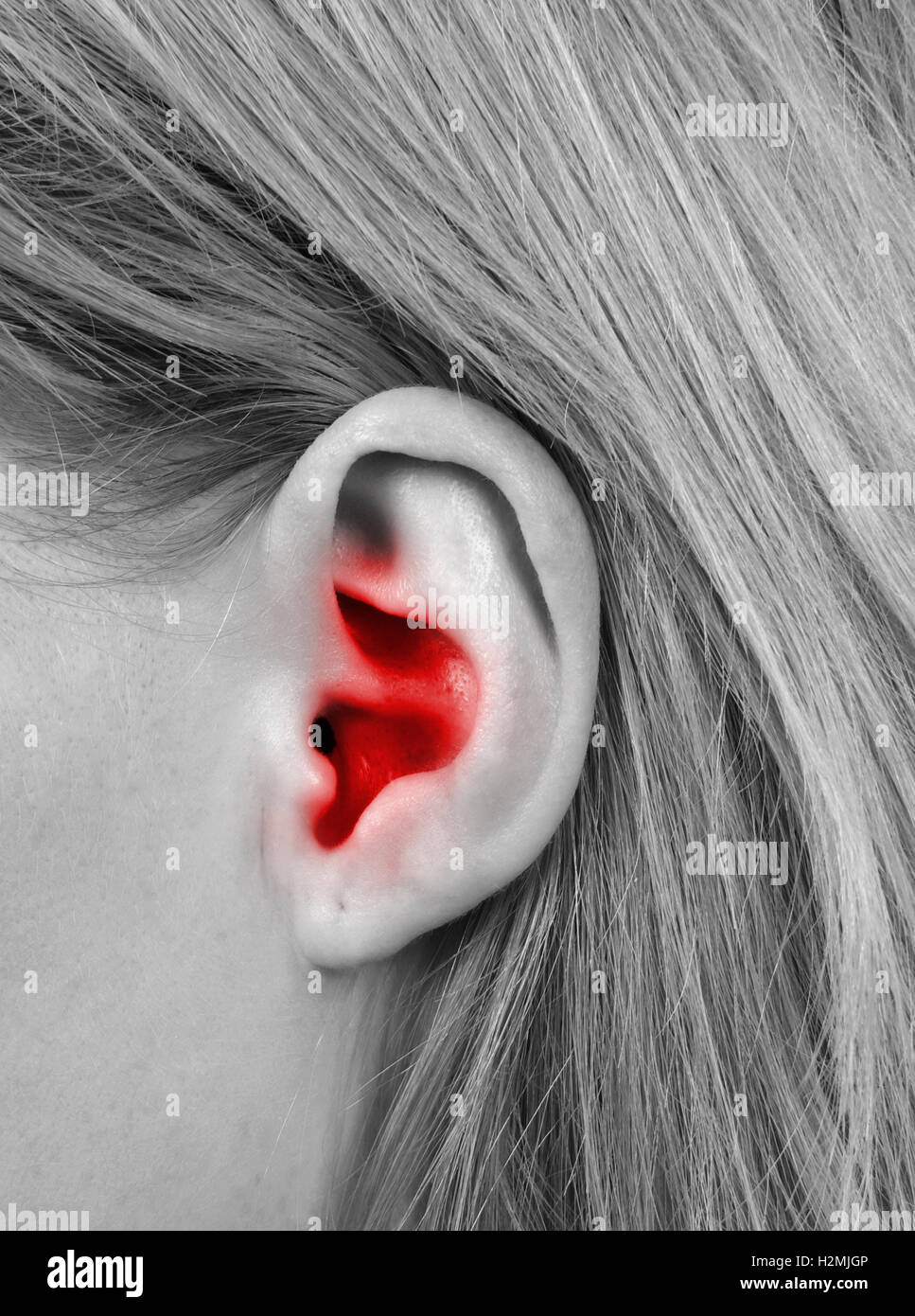 Woman face red swollen hi-res stock photography and images - Alamy