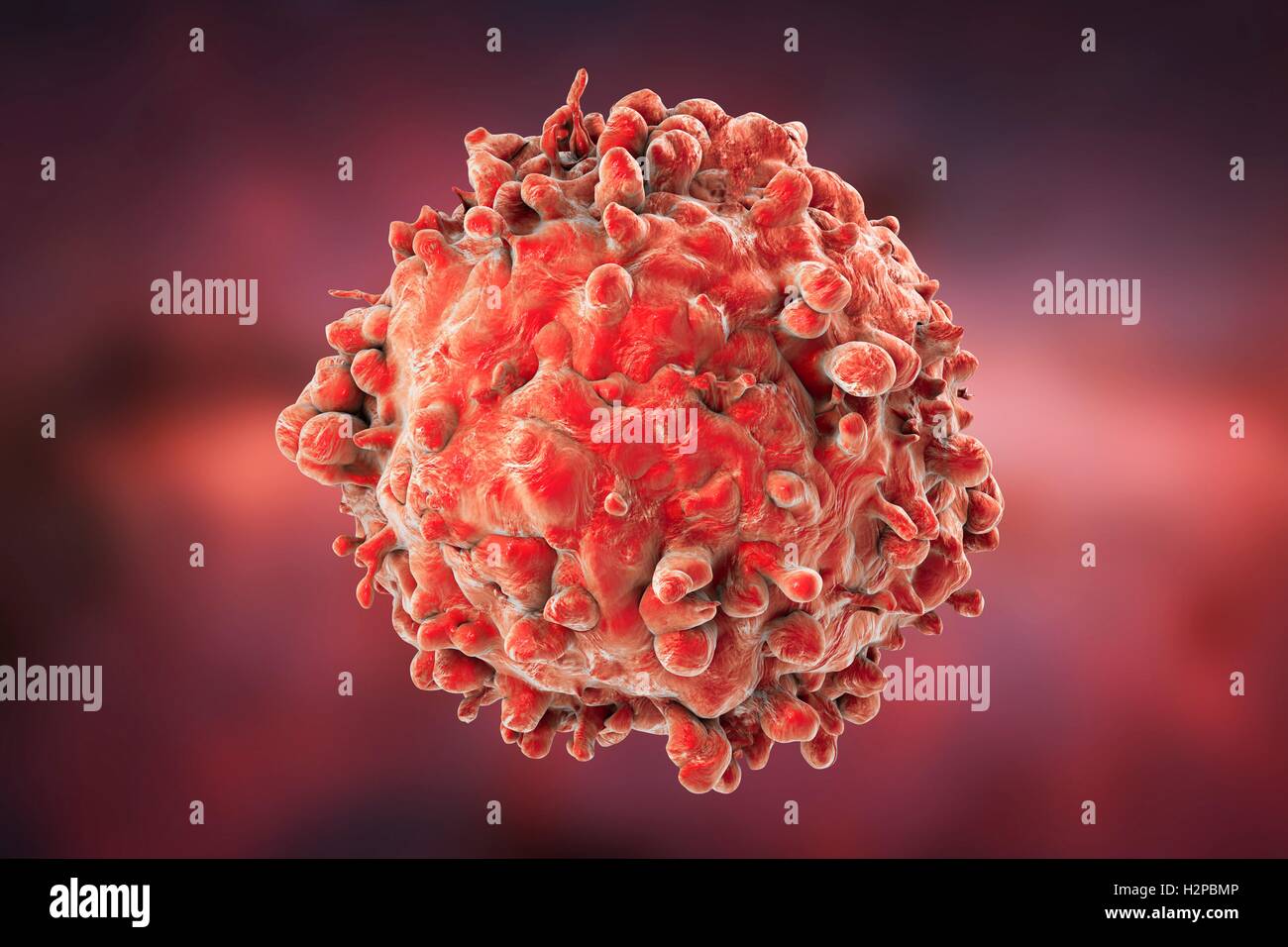 Computer illustration of a cancerous white blood cell in leukaemia ...