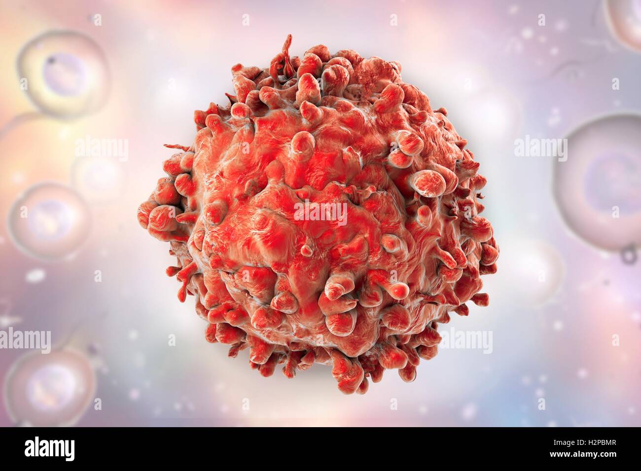 Cancerous hi-res stock photography and images - Alamy