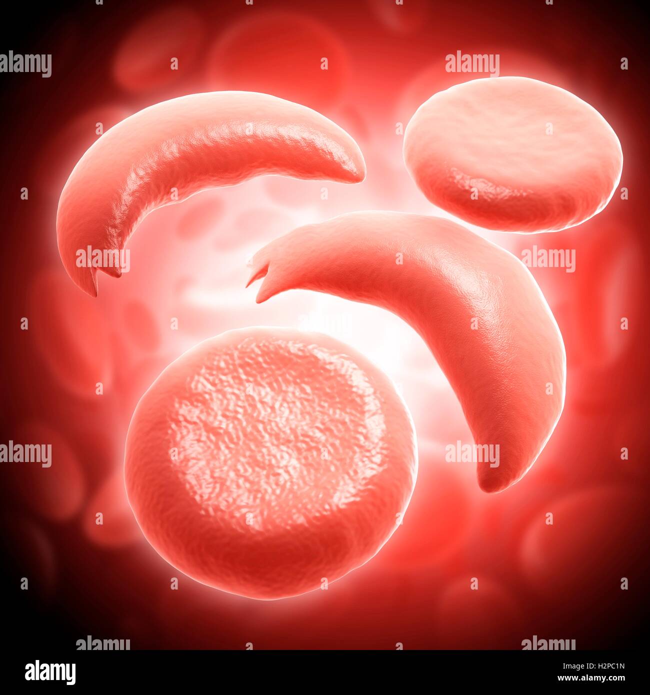 Illustration of red blood cells in sickle cell anaemia Stock Photo - Alamy