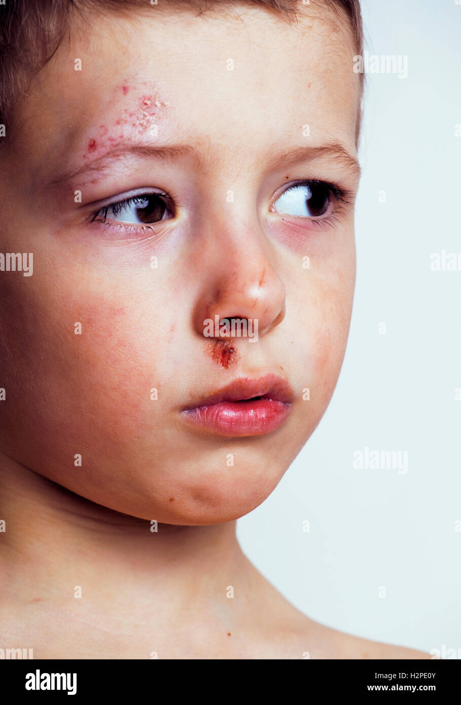 Little boy whipped close up Stock Photo - Alamy
