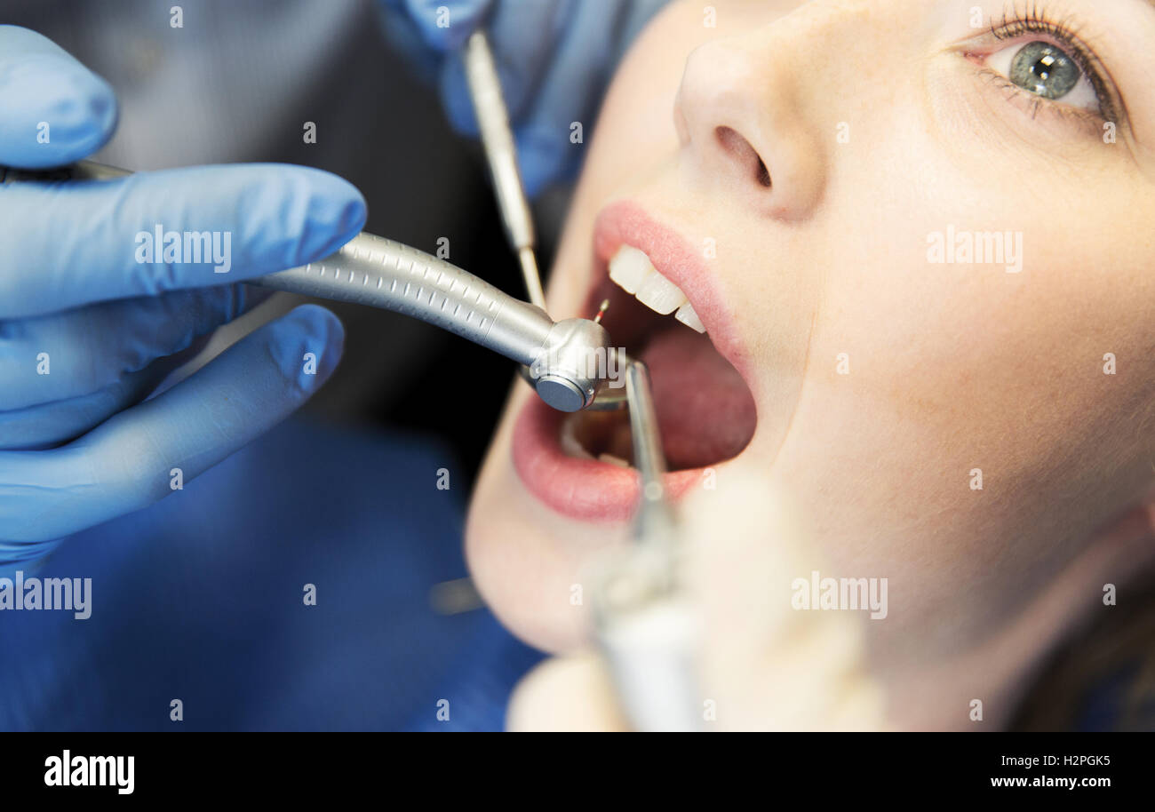 close up of patient having teeth treatment Stock Photo - Alamy