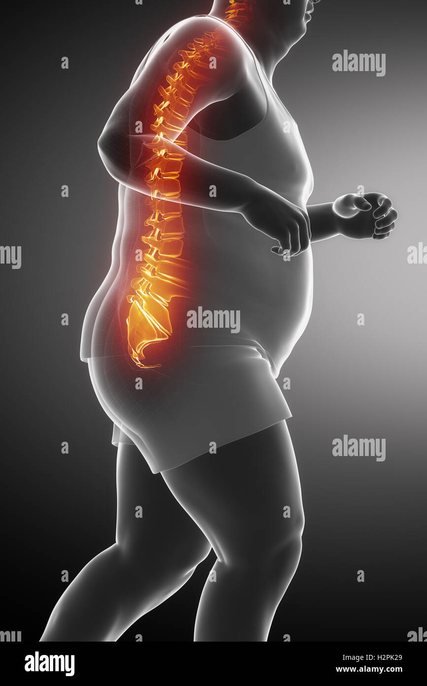 Fat man with backache Stock Photo - Alamy