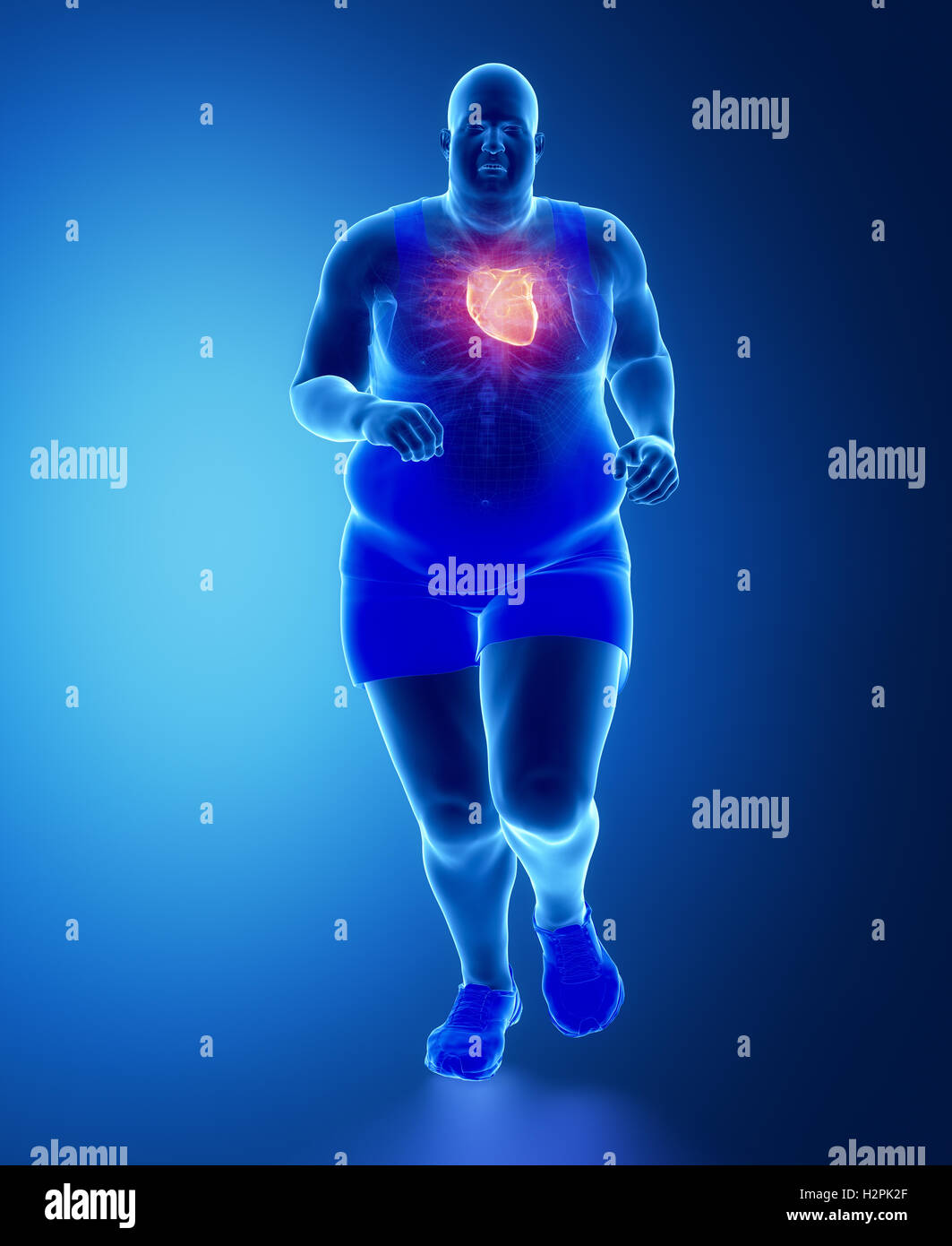 Running heart attack hi-res stock photography and images - Alamy