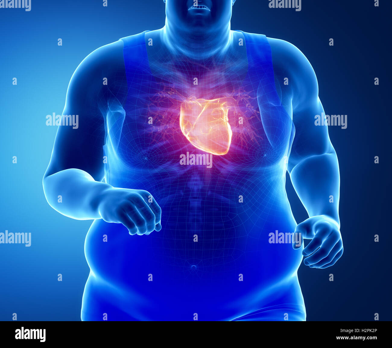 Fat obese man running with heart attack concept Stock Photo - Alamy