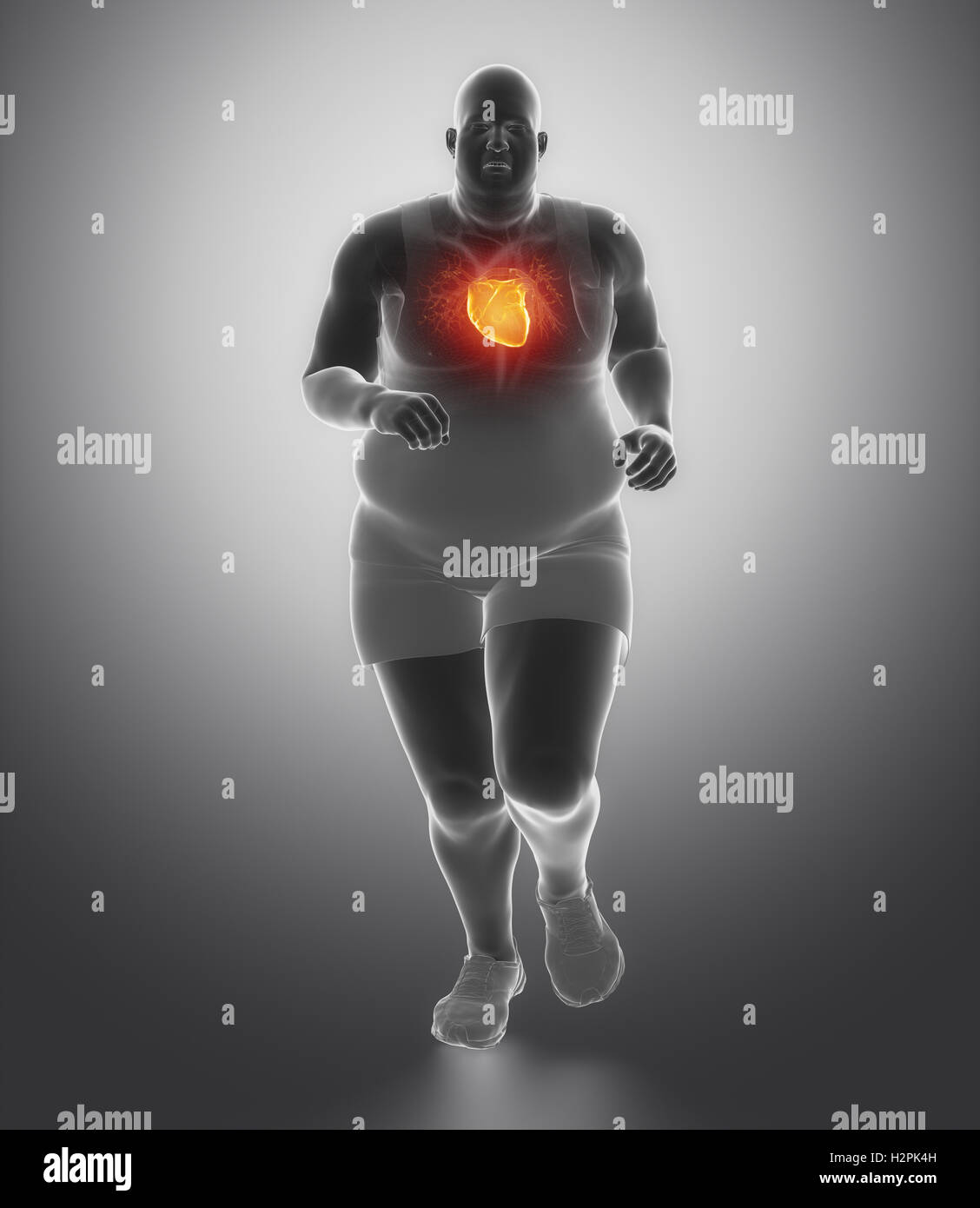 Obese man heart problem Stock Photo - Alamy
