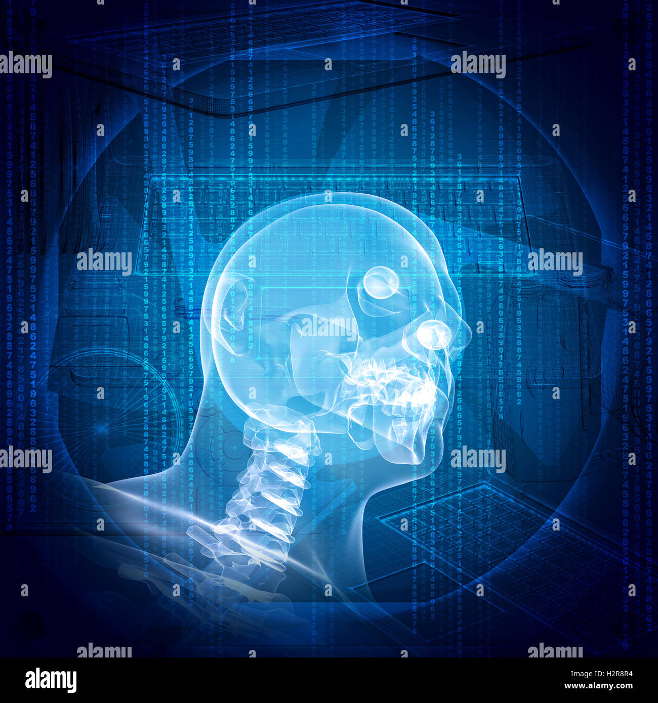 X-ray image of a man's head Stock Photo - Alamy