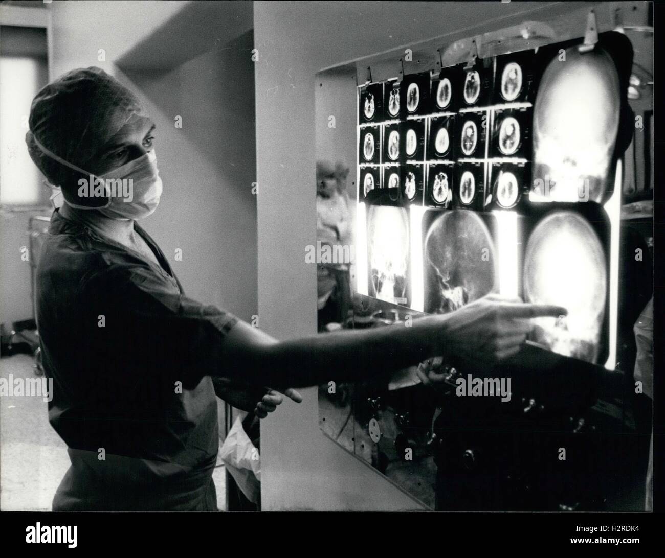 1961 - x ray radiology brain skull scan © Keystone Pictures USA ...