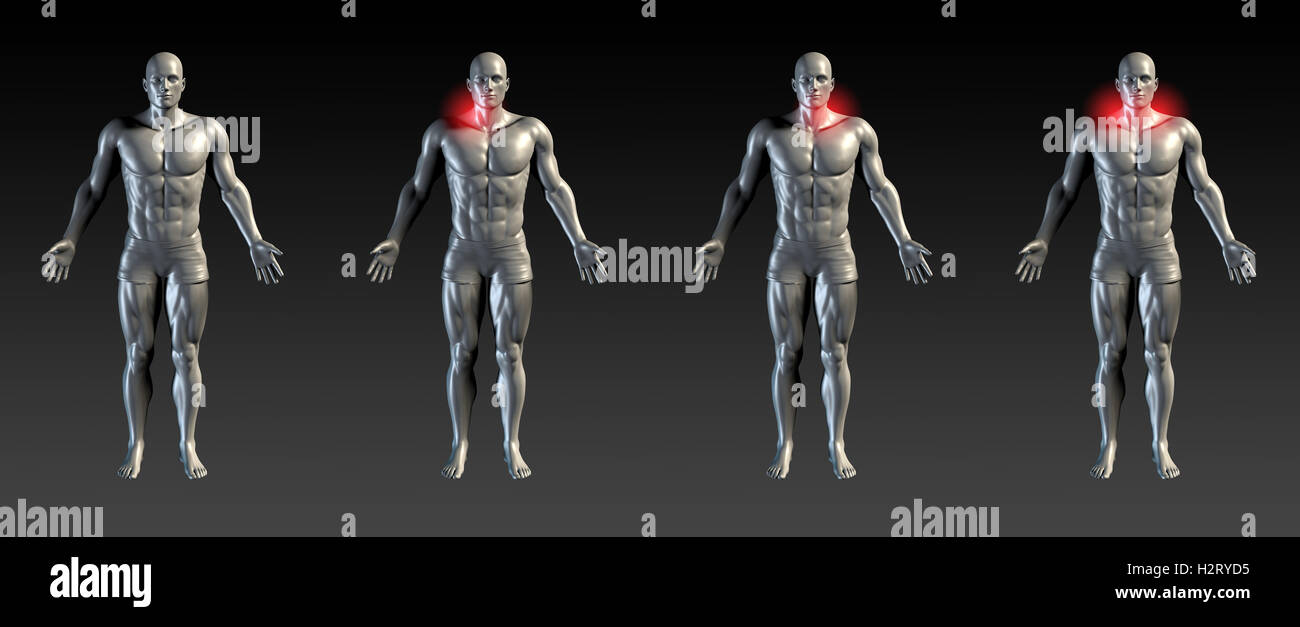 Neck Injury with Red Glow on Area Series Stock Photo - Alamy