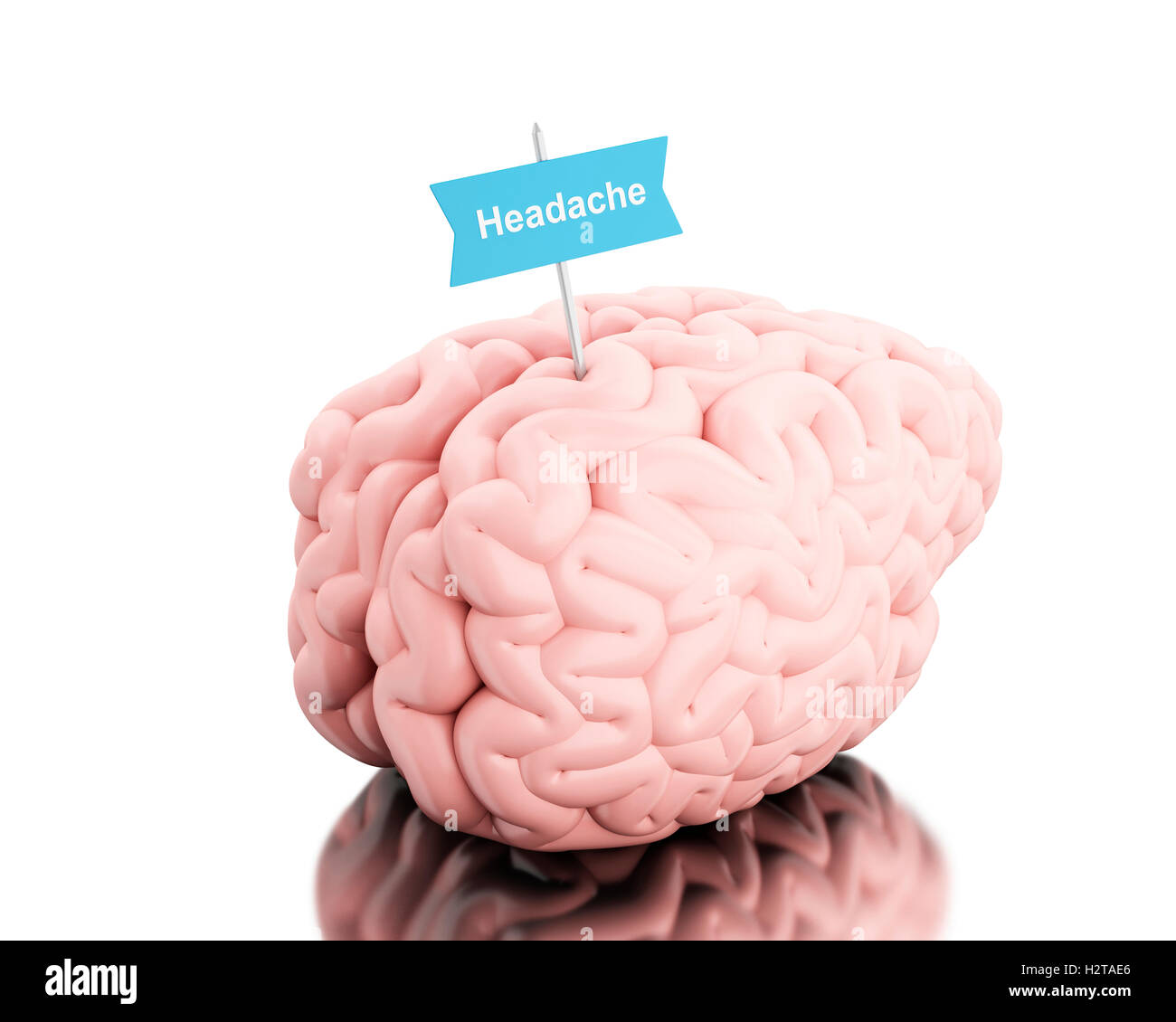 3D Illustration. Brain with a signboard and word headache. Isolated ...