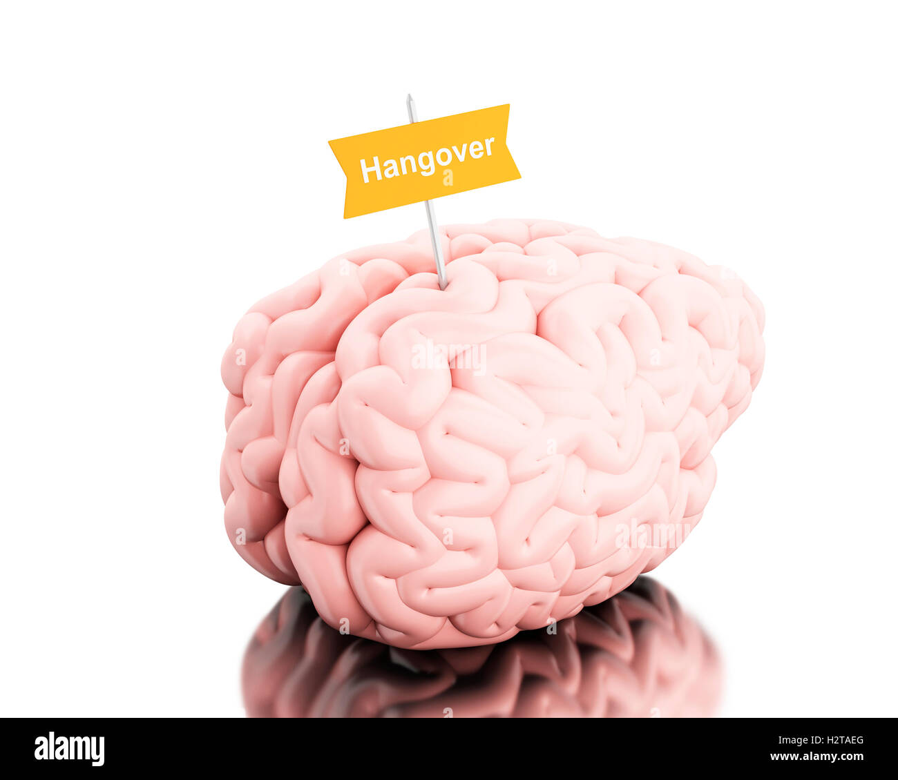 3D Illustration. Brain with a signboard and word hangover. Isolated ...