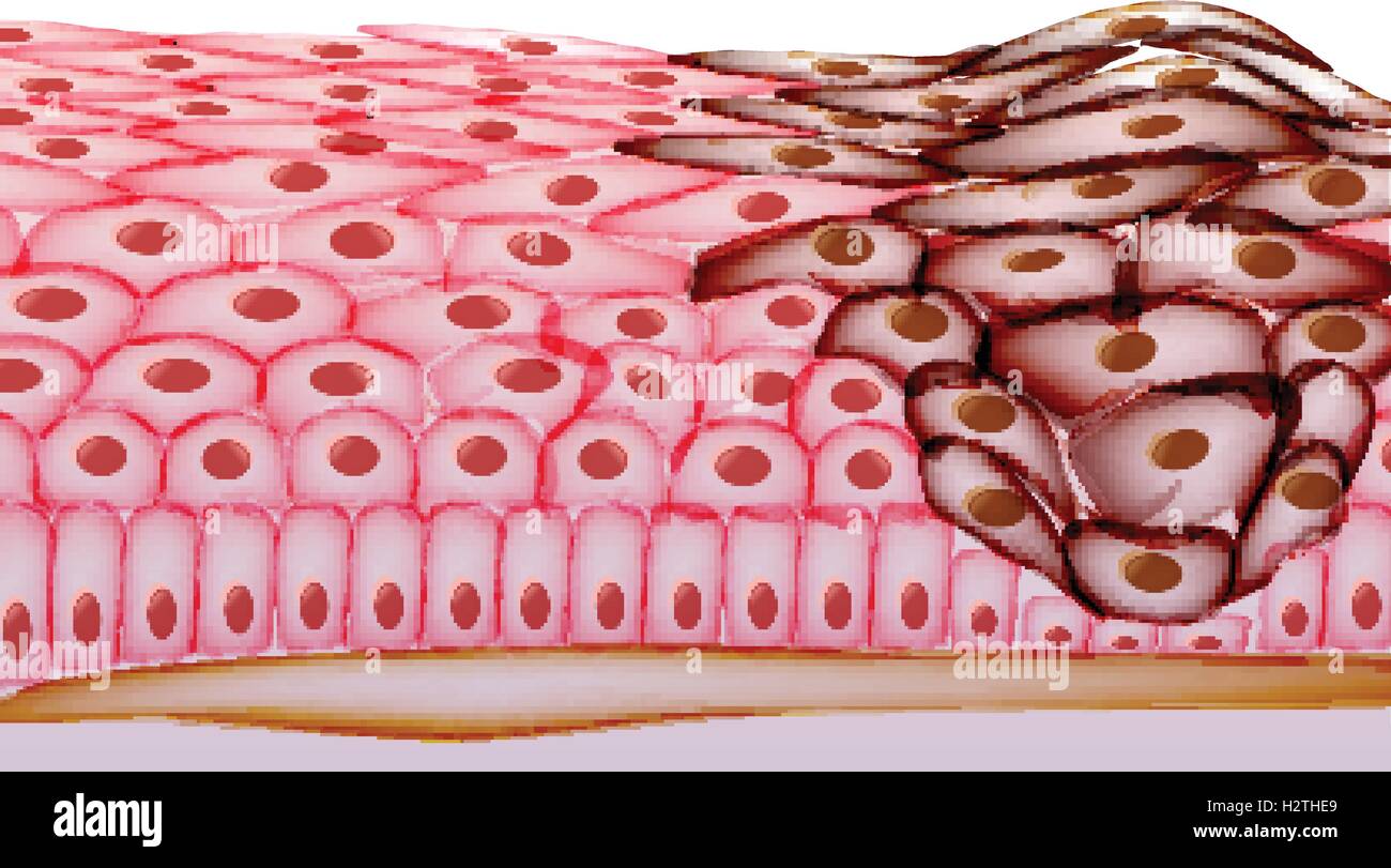 Epithelial tissue hi-res stock photography and images - Alamy