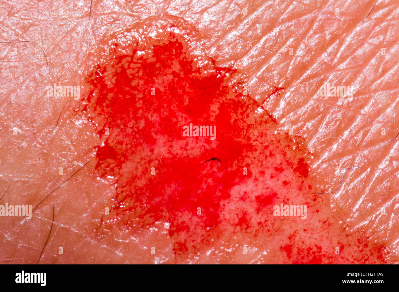 Blood Scratch Stock Photos & Blood Scratch Stock Images - Alamy