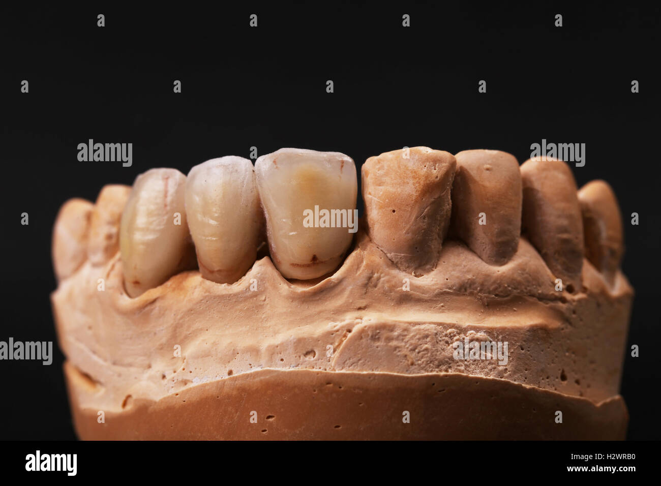 Human teeth imprint hi-res stock photography and images - Alamy