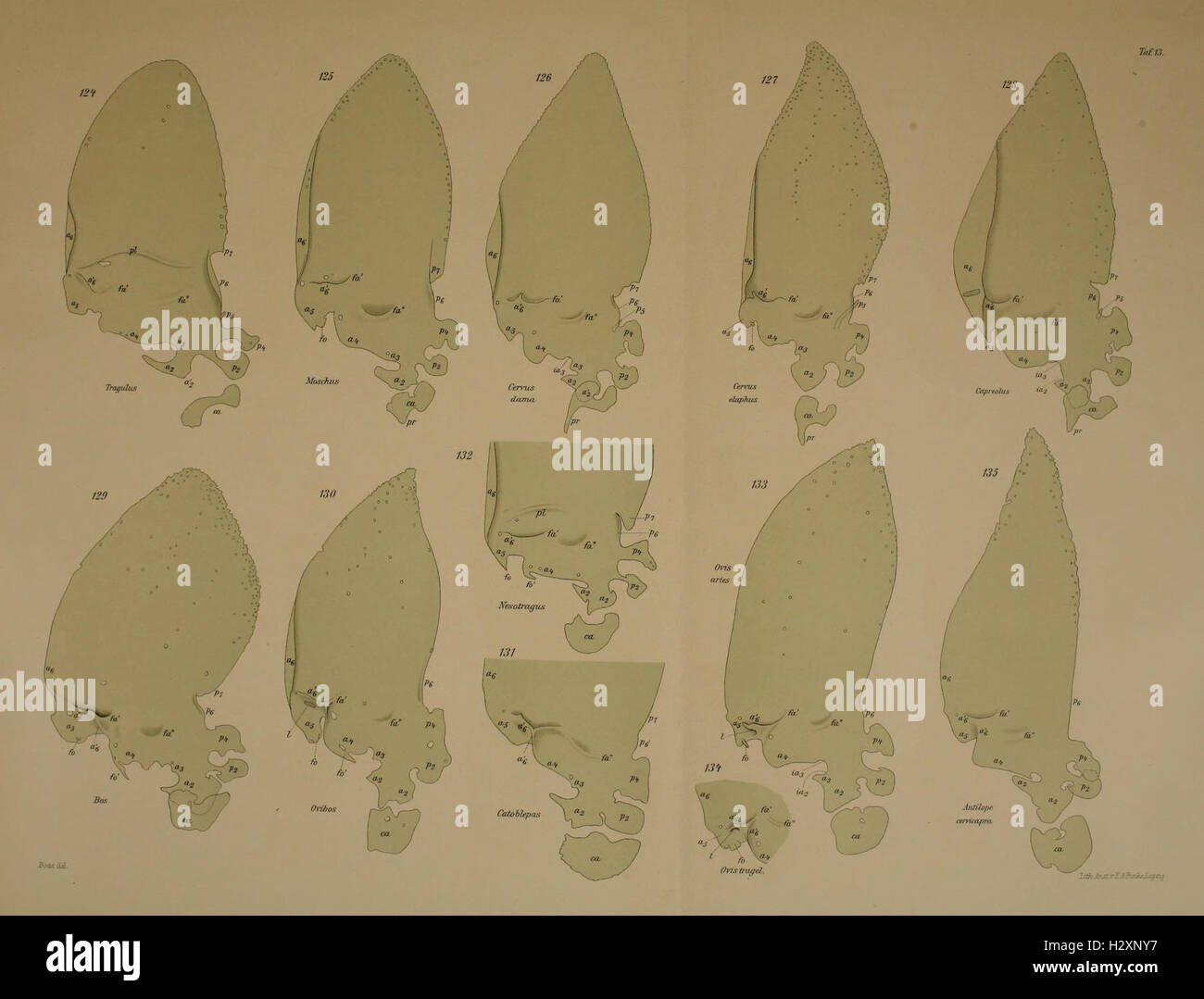 This plate focuses on the ear cartilage and outer ear structures of ...