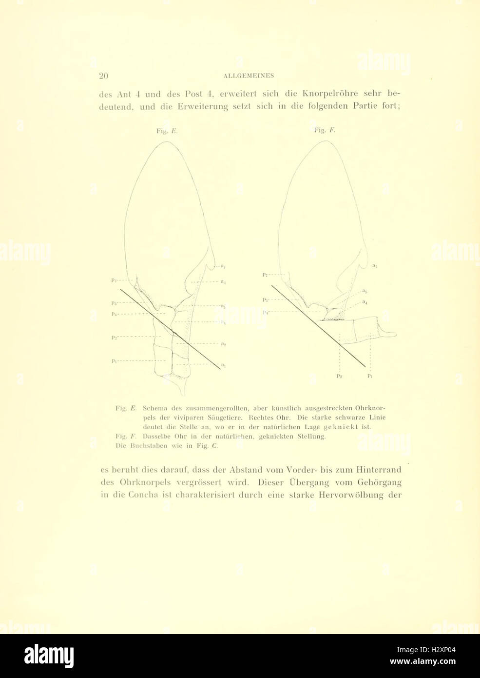 This anatomical study examines the ear cartilage and external ear ...