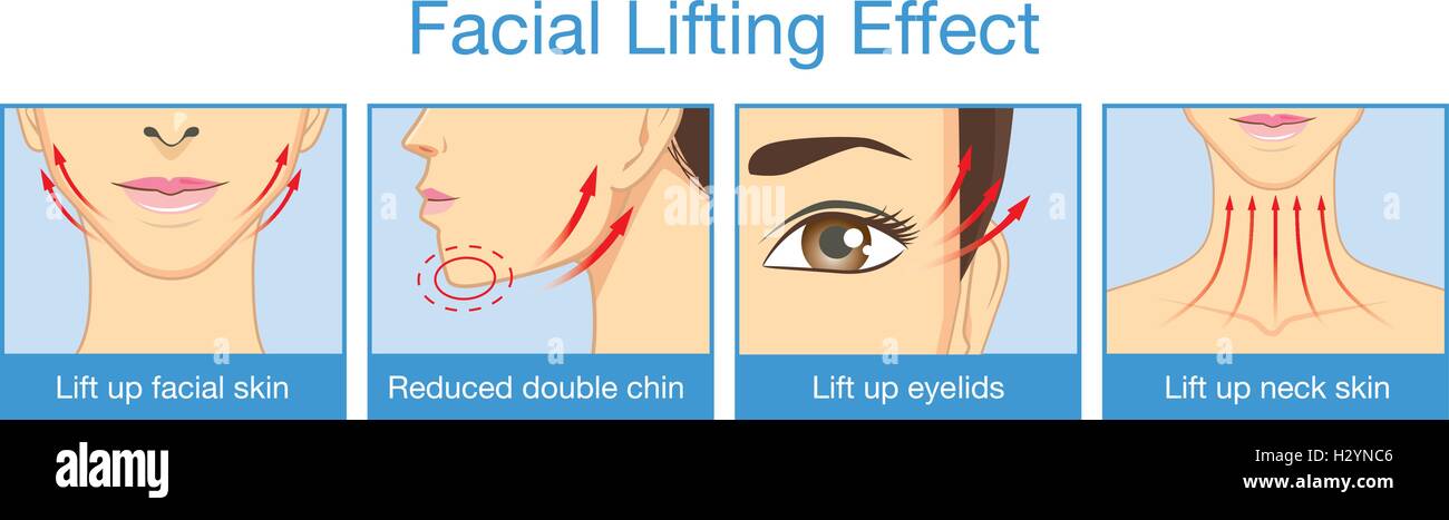 Lifting effect on facial of women Stock Vector Image & Art - Alamy