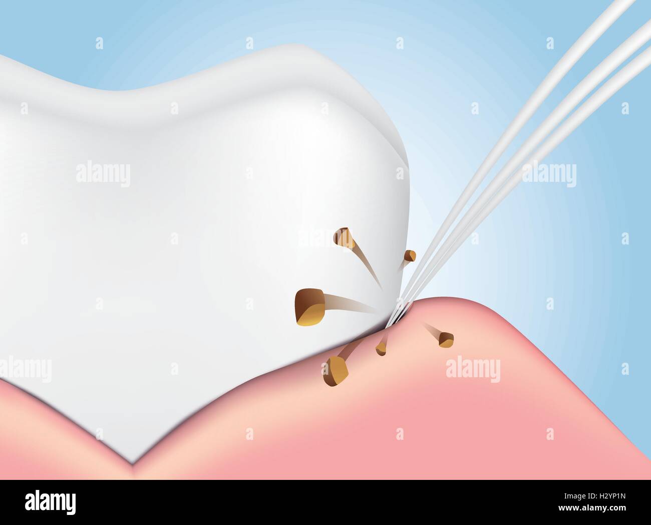 Sharp tool medical waste hi-res stock photography and images - Alamy
