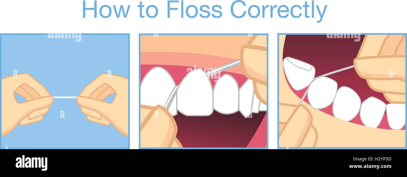 How to floss correctly for cleaning teeth Stock Vector Image & Art - Alamy